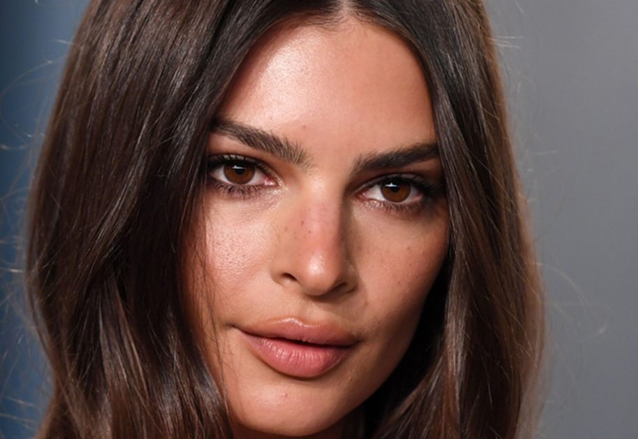 Freckles: Complete Guide to Embracing and Highlighting Them | Treatwell